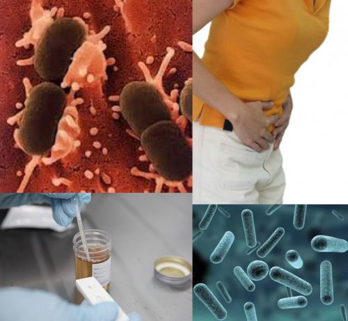 İdrar Yolu Enfeksiyonu