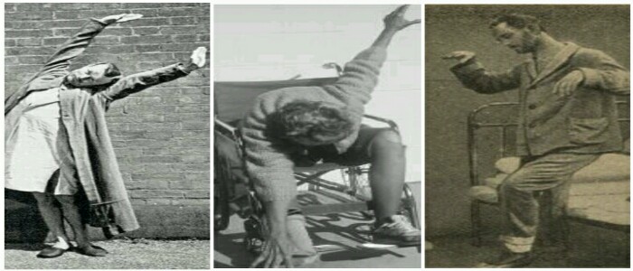 Katatonik Şizofreni